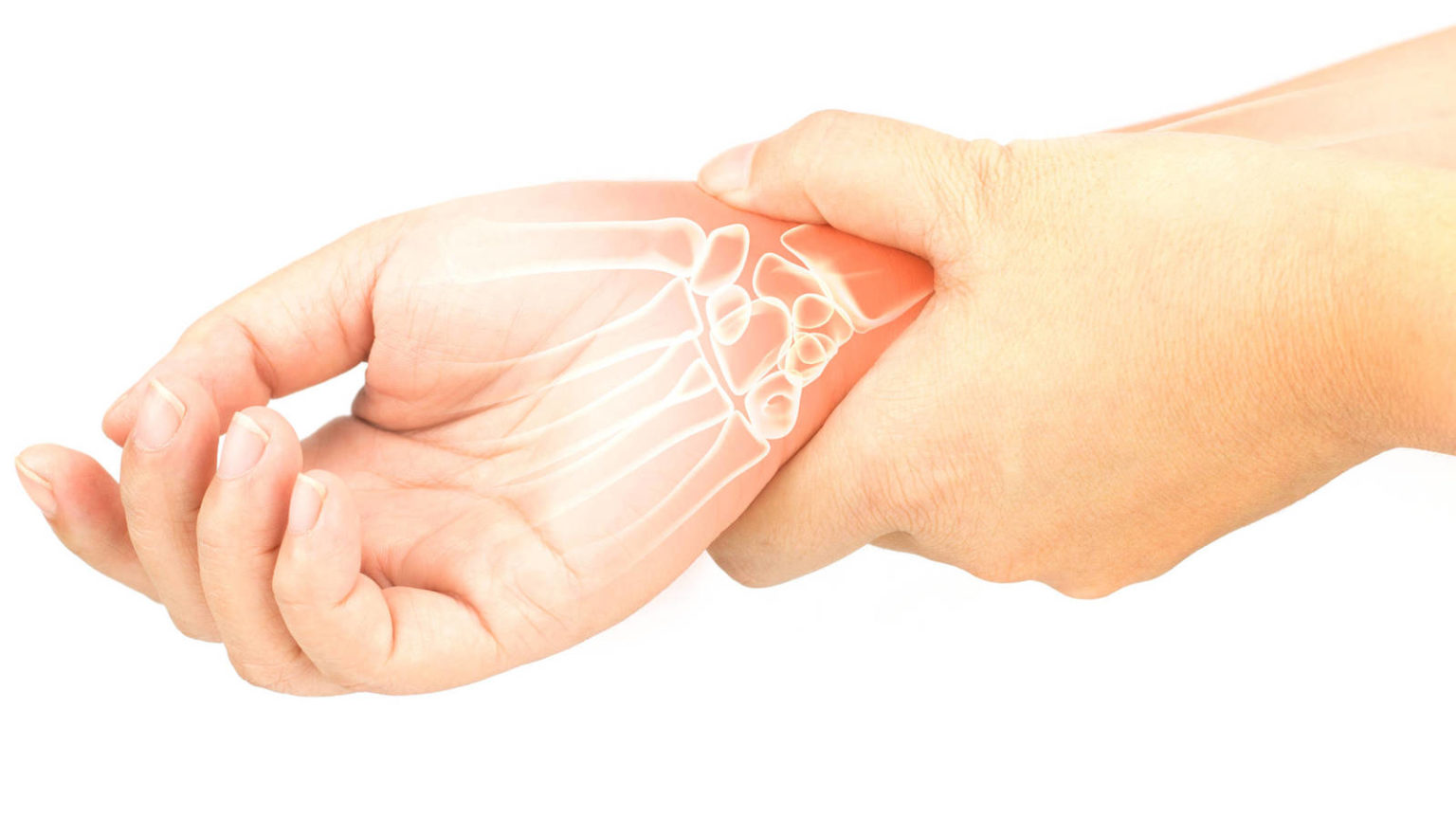 Cómo Controlar el Dolor de la Artritis Reumatoide ★